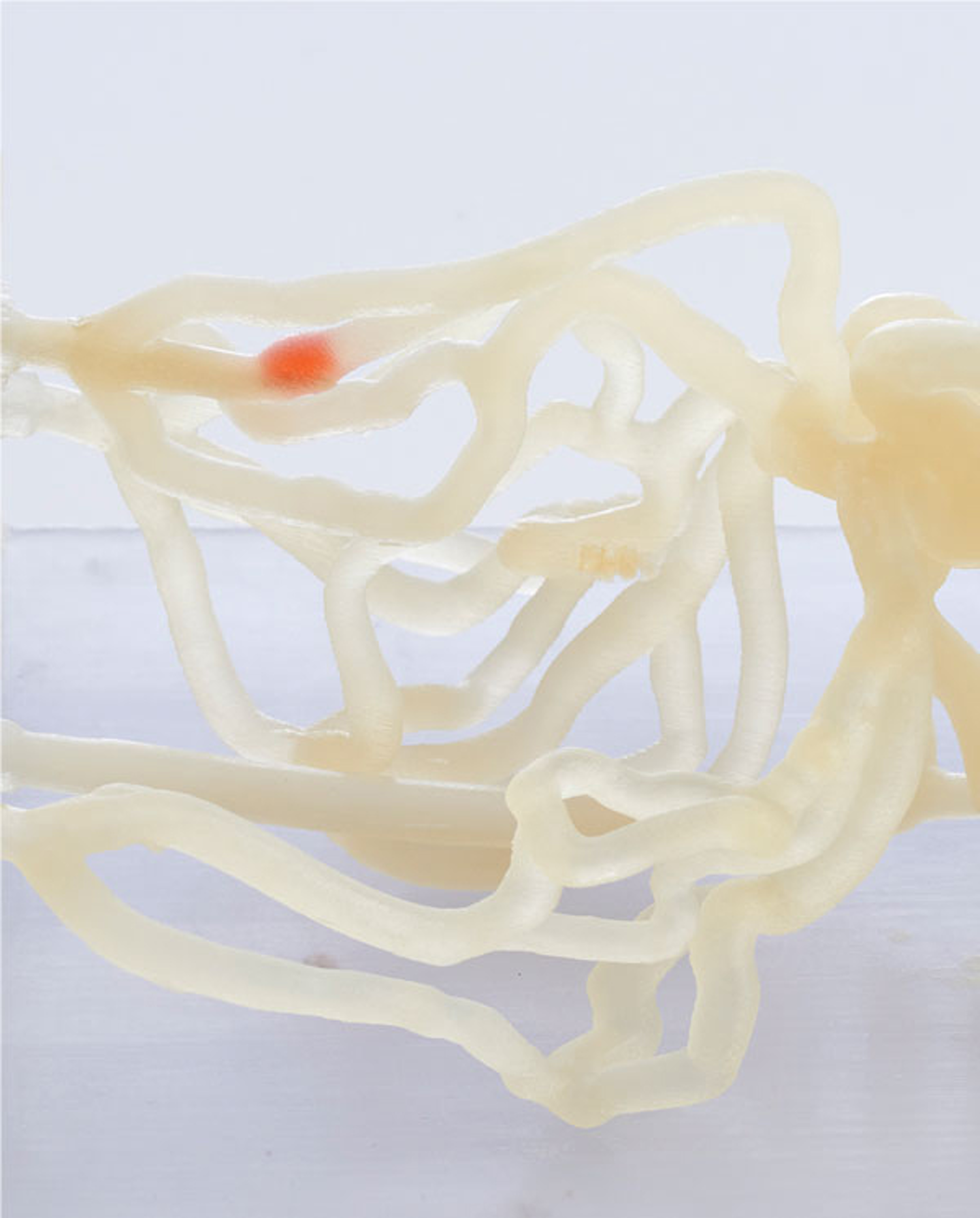 3D Printing Saves the World, Part 1 | Machine Design