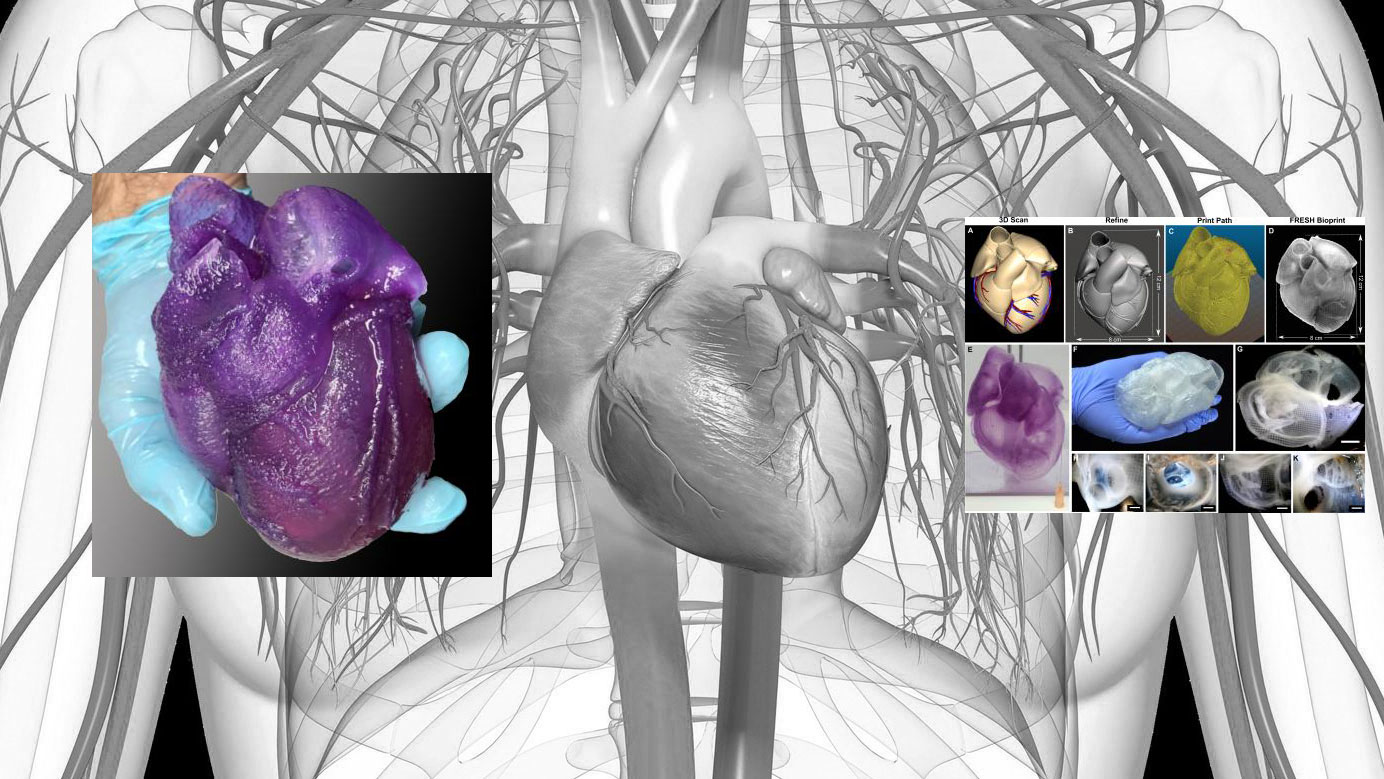 A FRESH Technique for Bioprinting Lifelike Heart Models | Machine Design