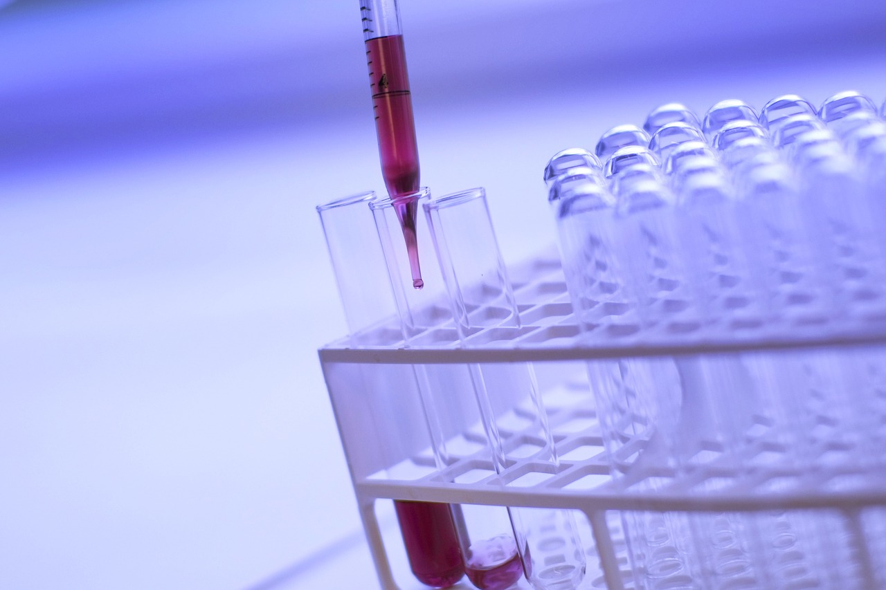 Ortho's COVID-19 IgG antibody test receives CE Mark | MLO Online